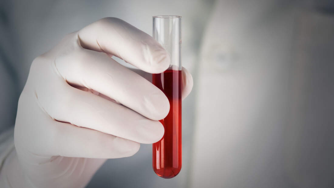 Blutwerte verstehen: Das sagt dein Blutbild | WOMEN'S HEALTH